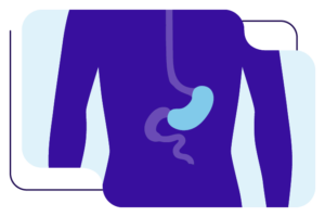 Preventing breast cancer | World Cancer Research Fund